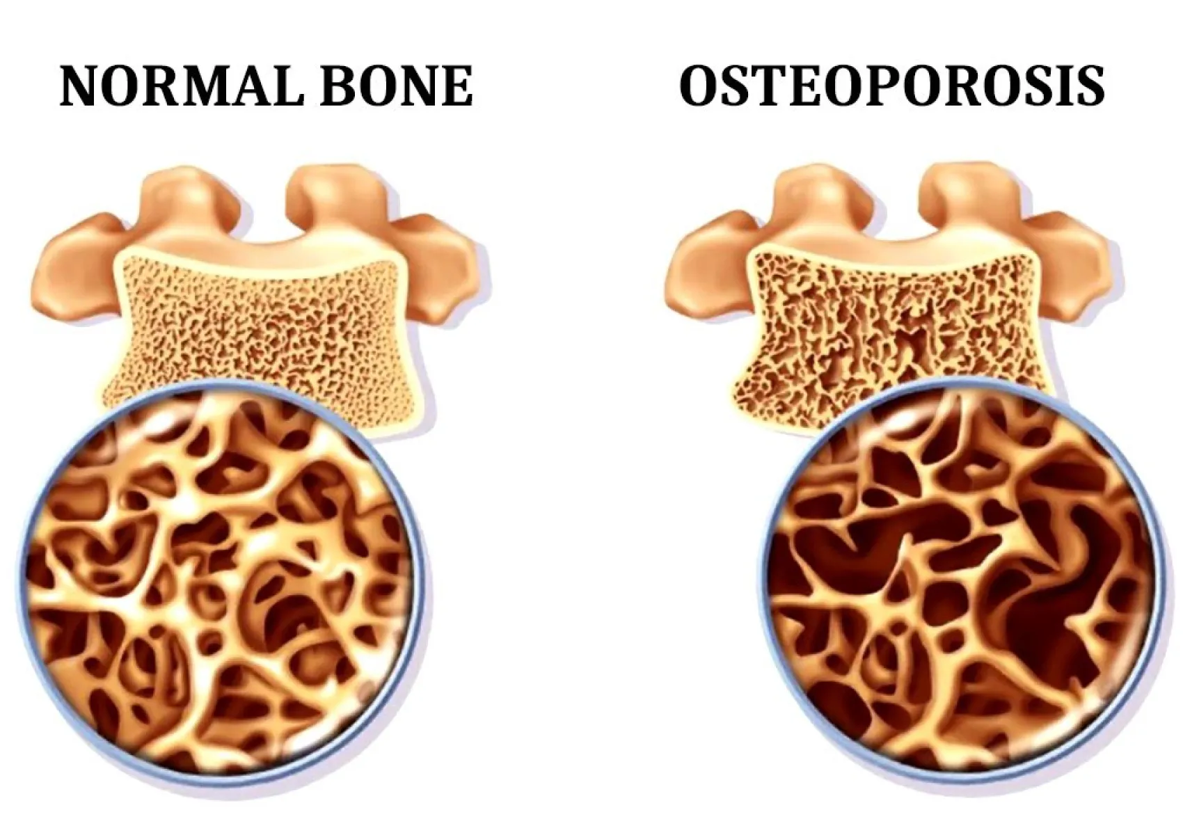 Common Causes of Back Pain | Proliance Orthopedic