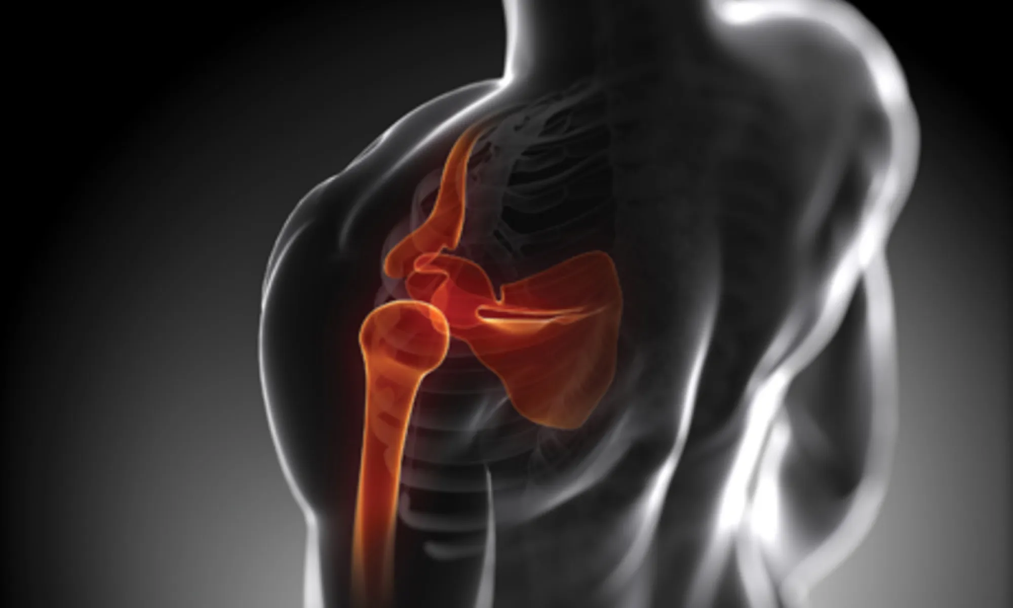 Common Shoulder Problems | Proliance Orthopedic