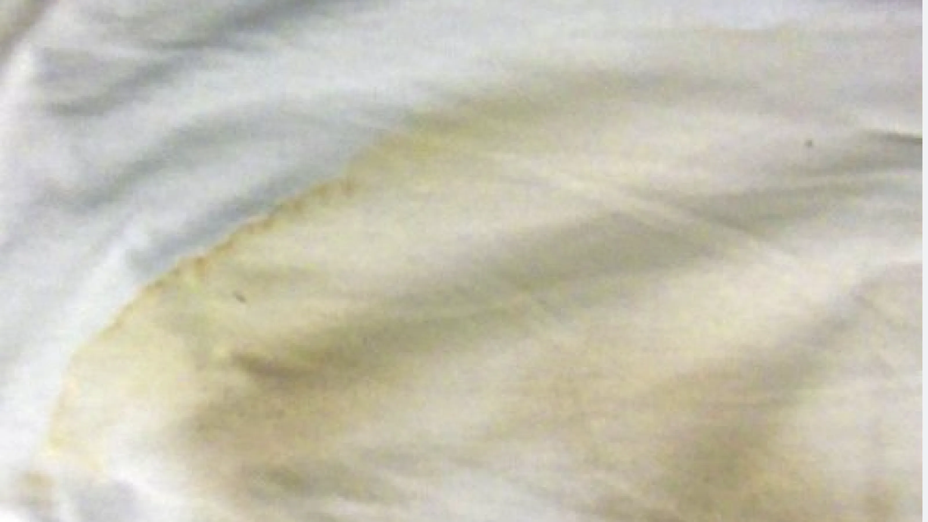 Invisible Stains | Lapels Cleaners