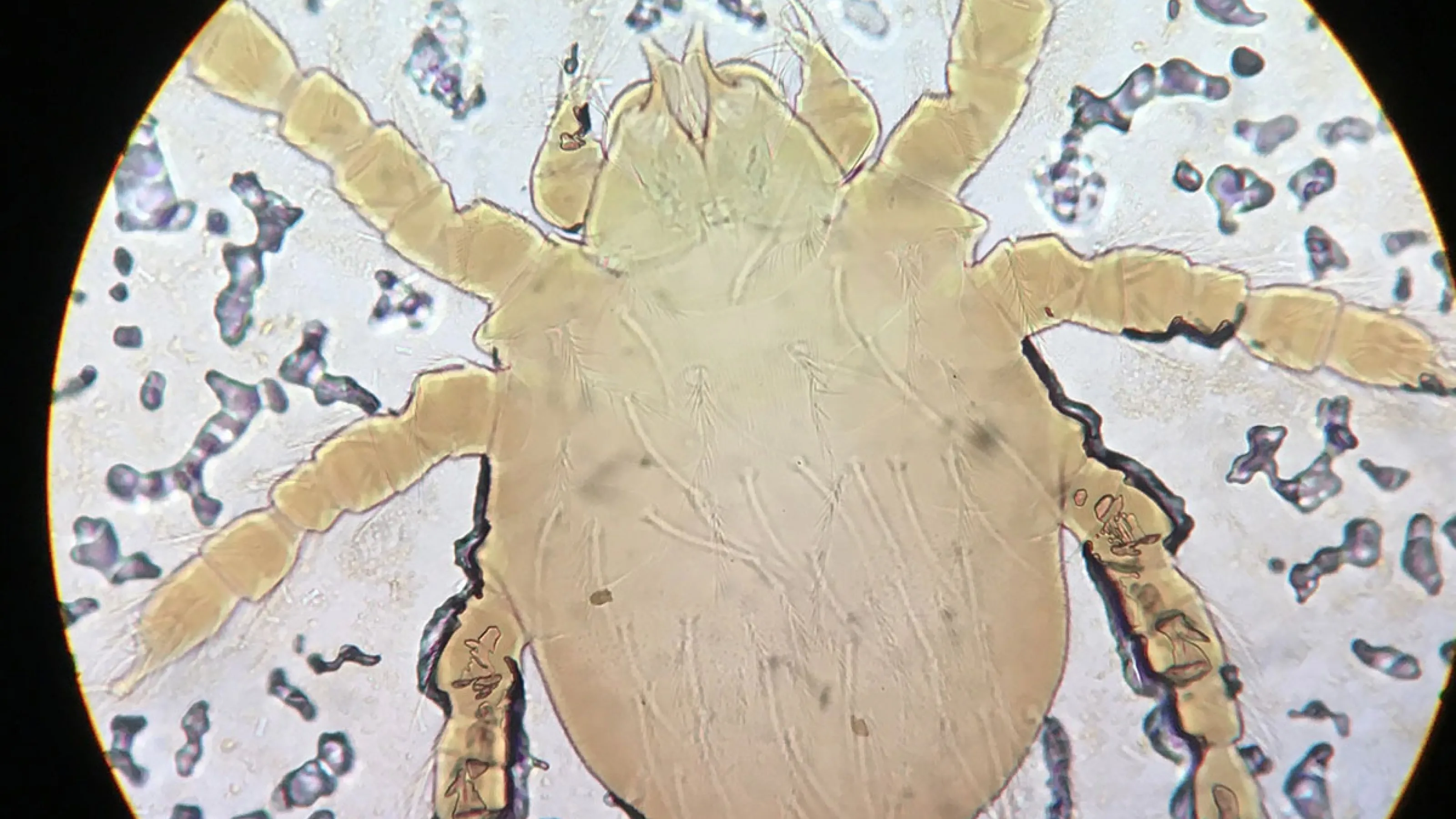 Chiggers | Pest Control Library | Palmetto Exterminators