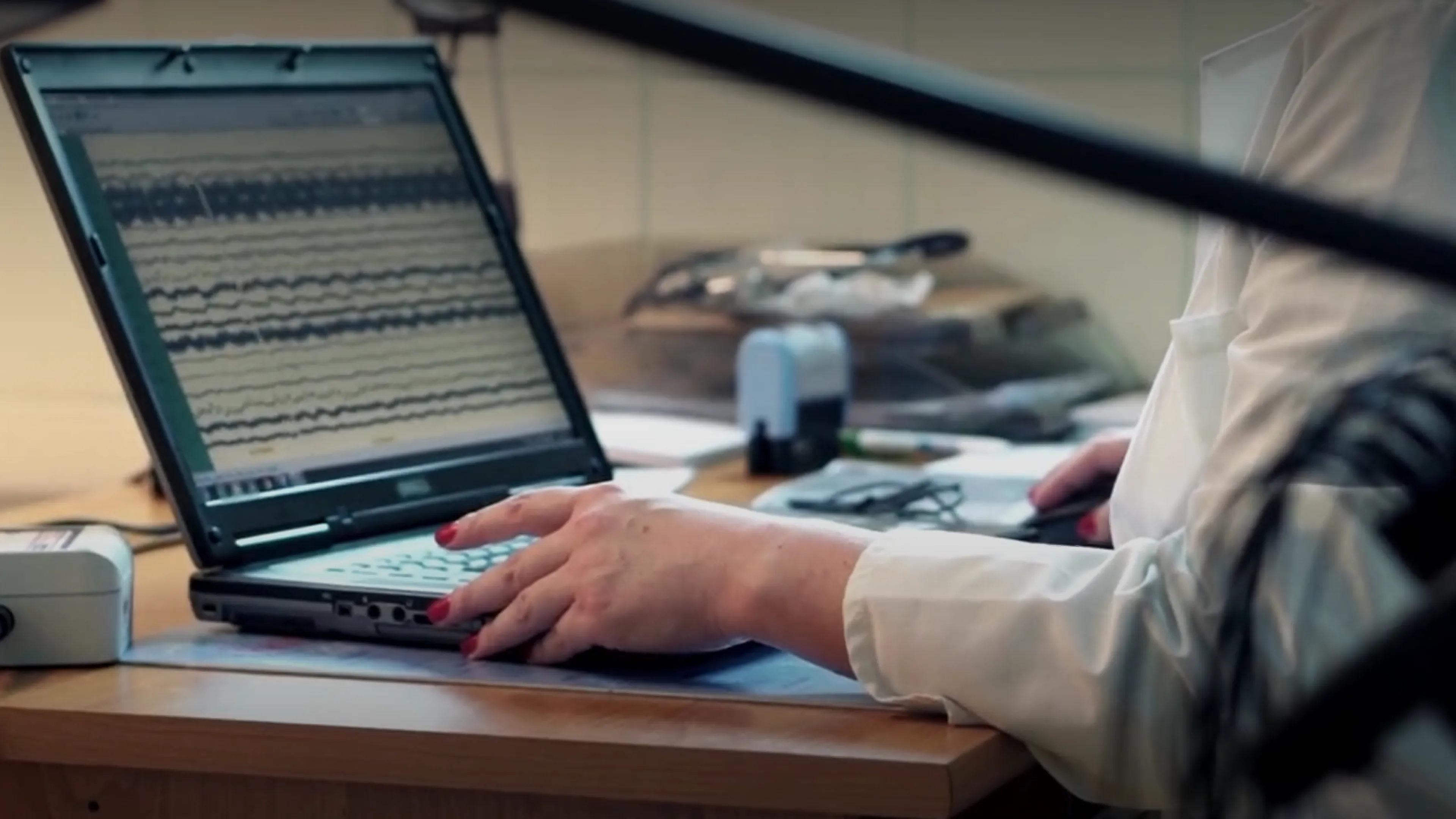 EMG/NCV Testing for Nerve & Muscle Evaluation | OrthoSouth