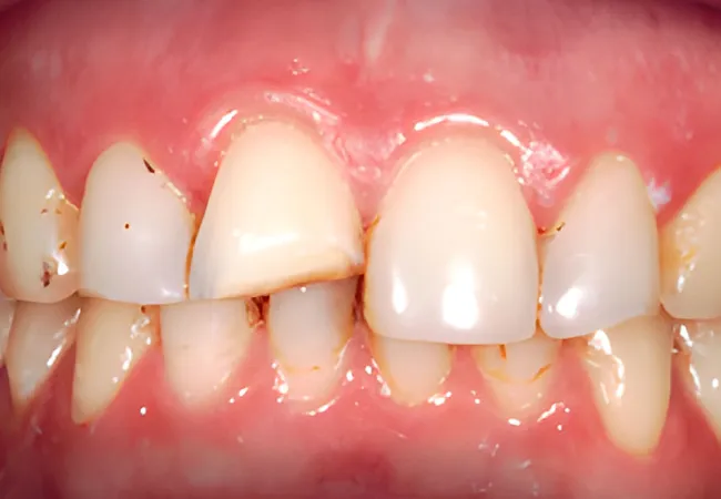 Parkland FL Dentists | Dedicated Dental Group Parkland | Dedicated ...