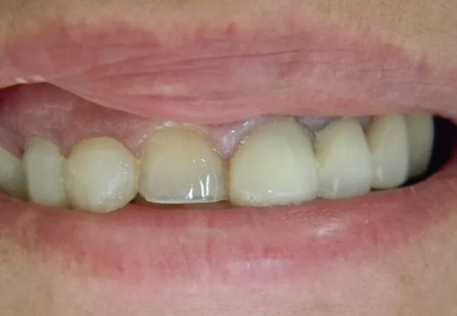 Smile Gallery in Boynton Beach, FL | Healthy Dental Expressions