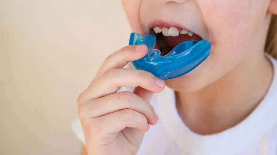 Mouthguards Cornelius, NC | Lakehouse Dental | Lakehouse Dental