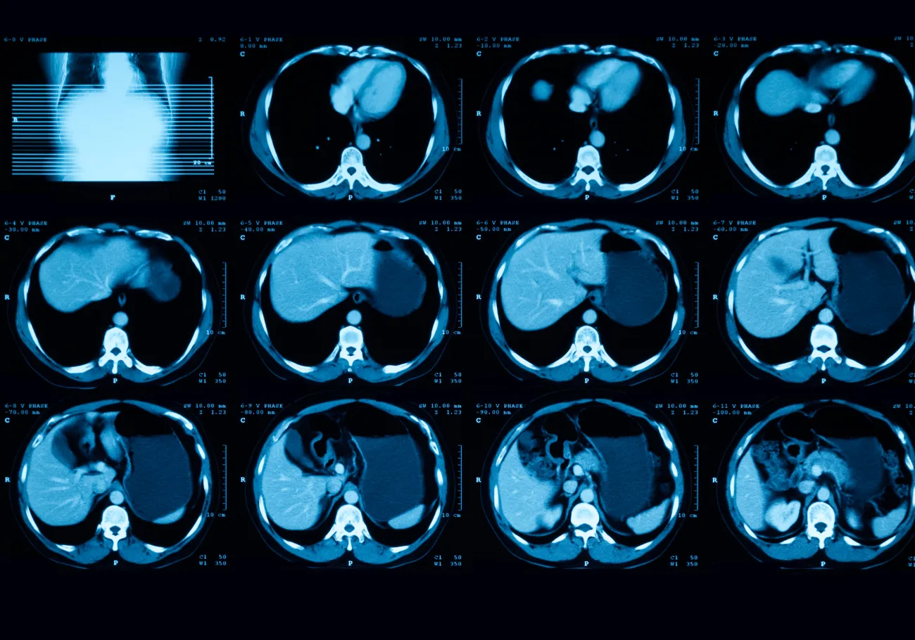 CT & CTA Scan Services - Summit Medical Group
